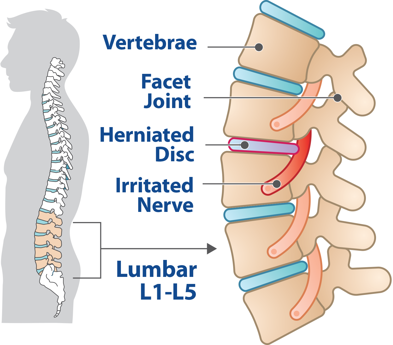 What Do You Know About Low Back Anatomy - PMCOA